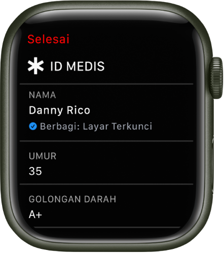 Mengatur dan melihat ID Medis Anda di Apple Watch - Apple Support (ID)